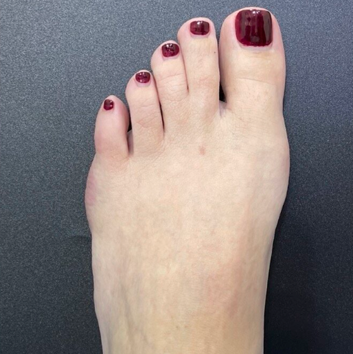 Big Toe Straighteners – HYGGEAR