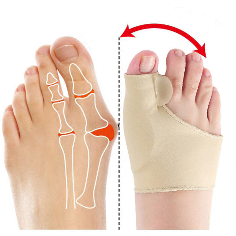 Hyggear Hallux Valgus Korrektoren – Bewährte Linderung & 60% Rabatt ... Hyggear Hallux Valgus Korrektoren – Bewährte Linderung & 60% Rabatt ...